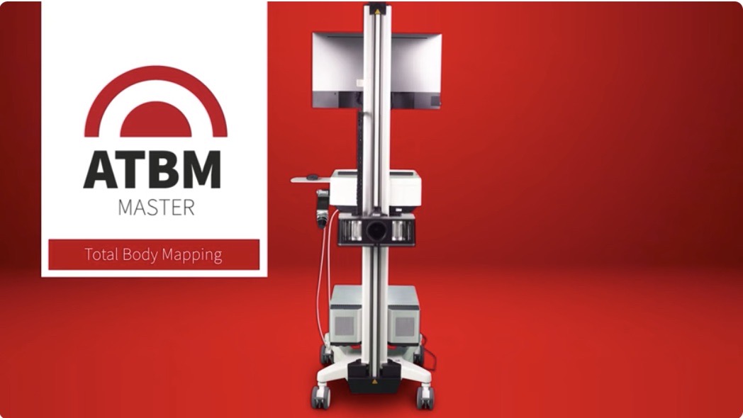 Digital Mole Mapping | Stoke on Trent | Staffordshire